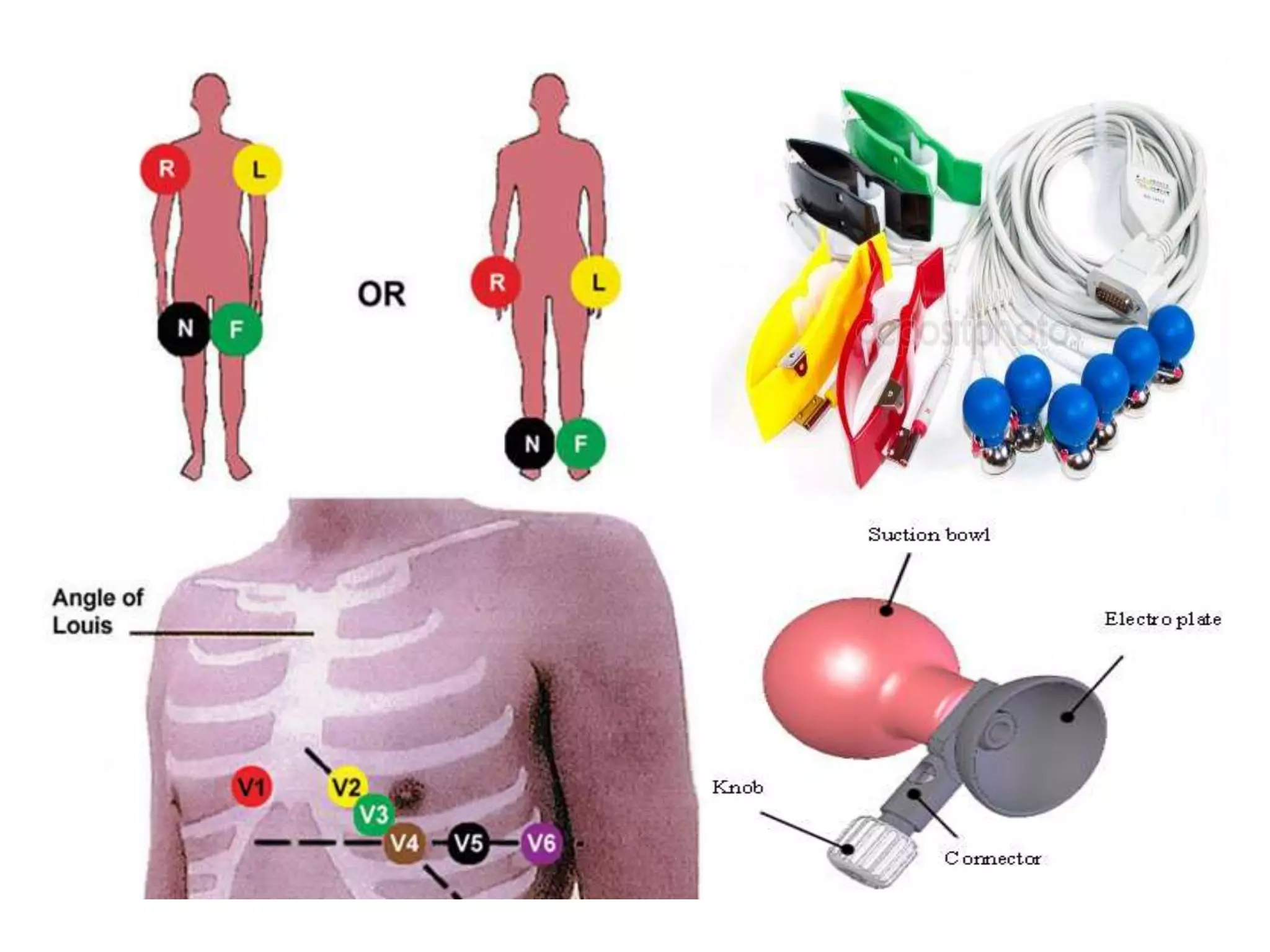 Basic electrocardiography and Beyond | PPT