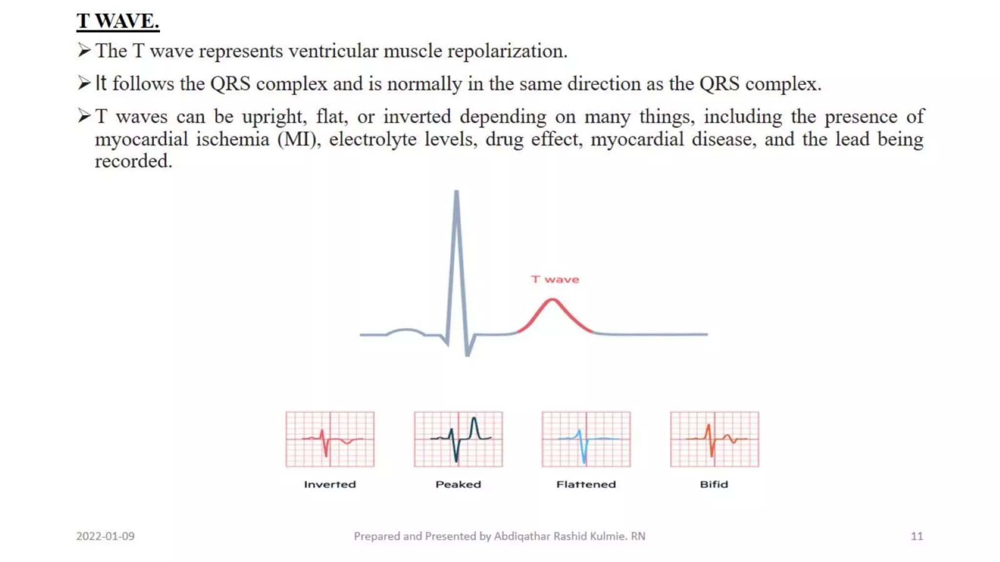 Basic electrophysiology, interpretation, cardiac monitoring and ...