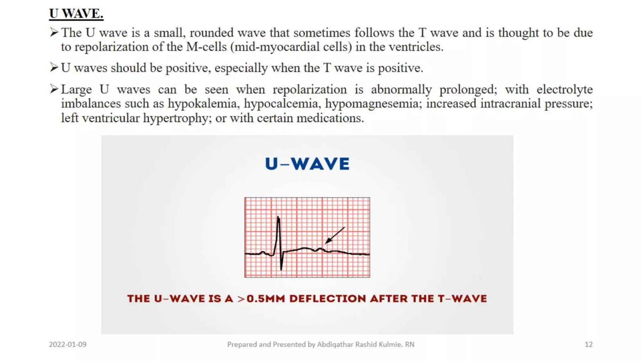 Basic electrophysiology, interpretation, cardiac monitoring and ...