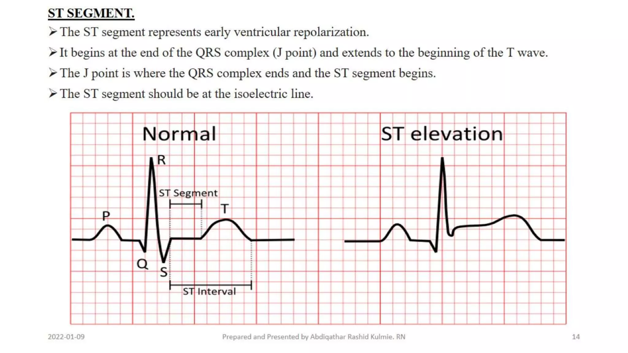 Basic electrophysiology, interpretation, cardiac monitoring and ...