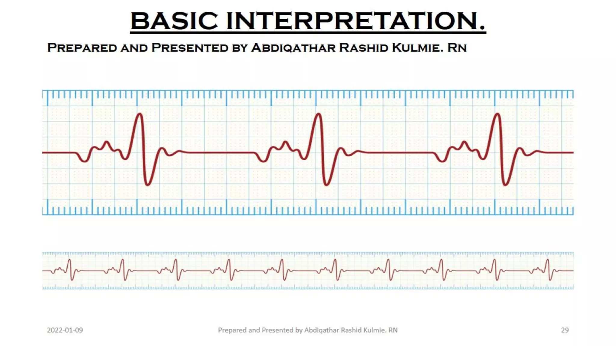 Basic electrophysiology, interpretation, cardiac monitoring and ...