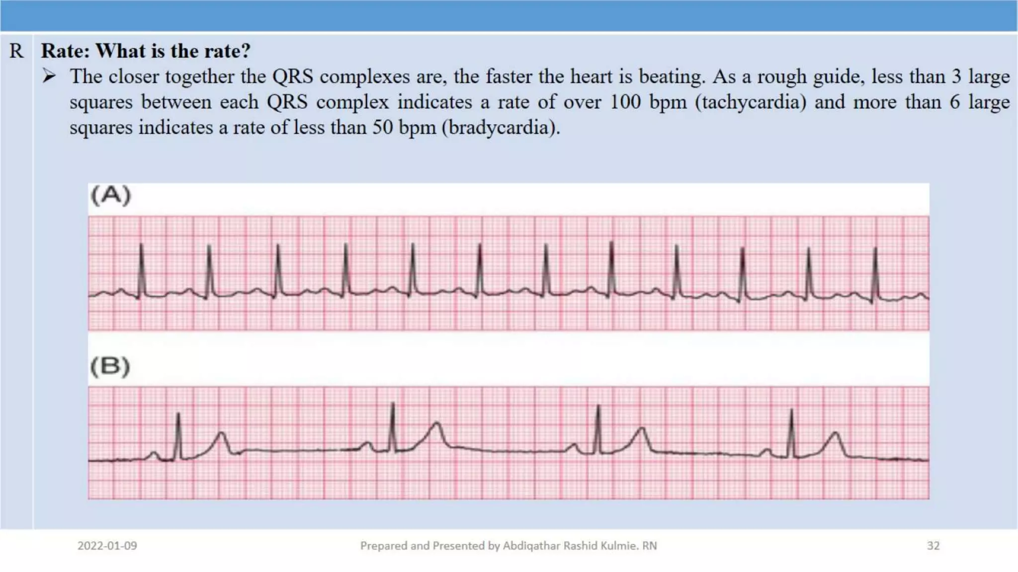 Basic electrophysiology, interpretation, cardiac monitoring and ...