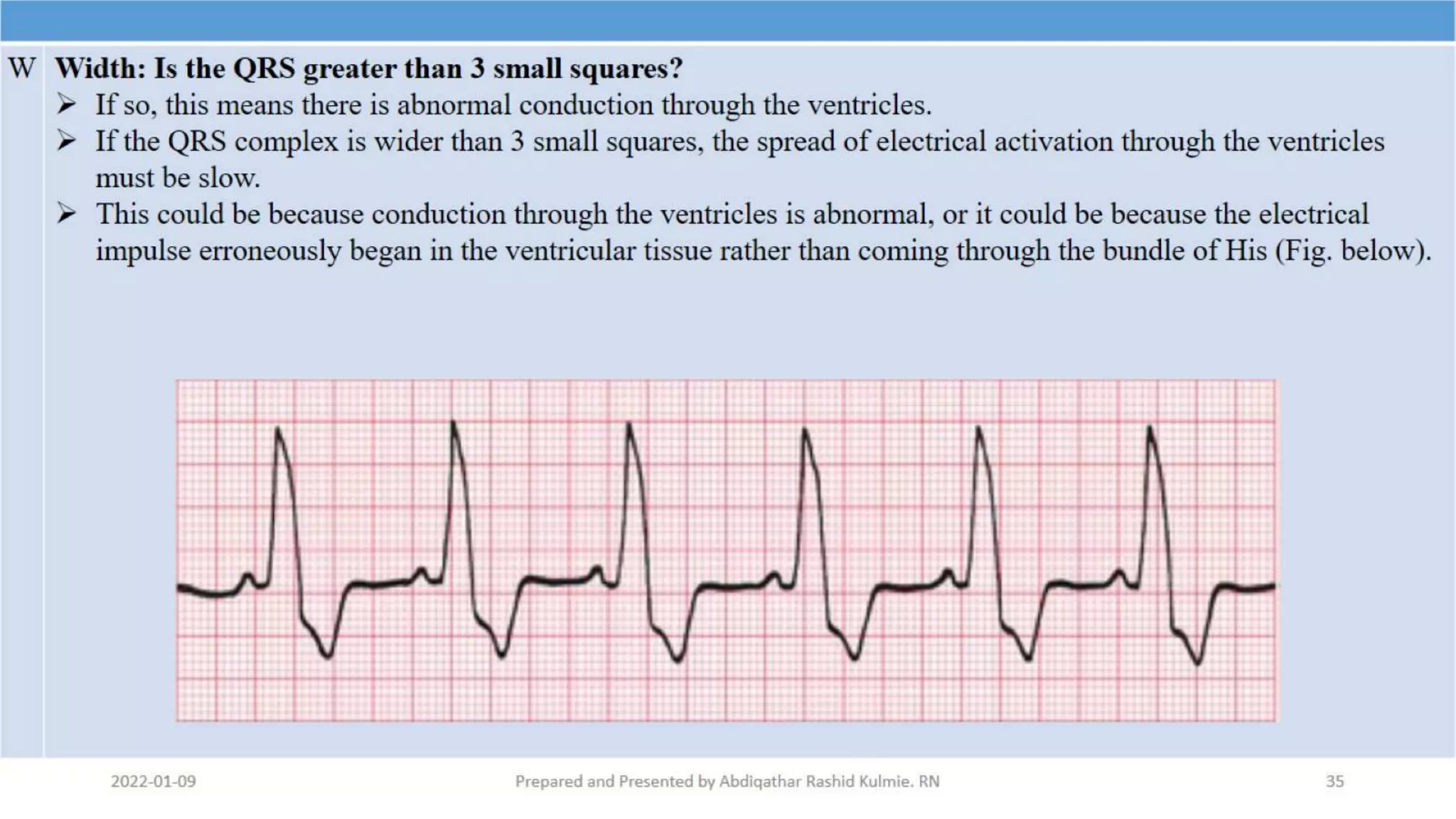 Basic electrophysiology, interpretation, cardiac monitoring and ...