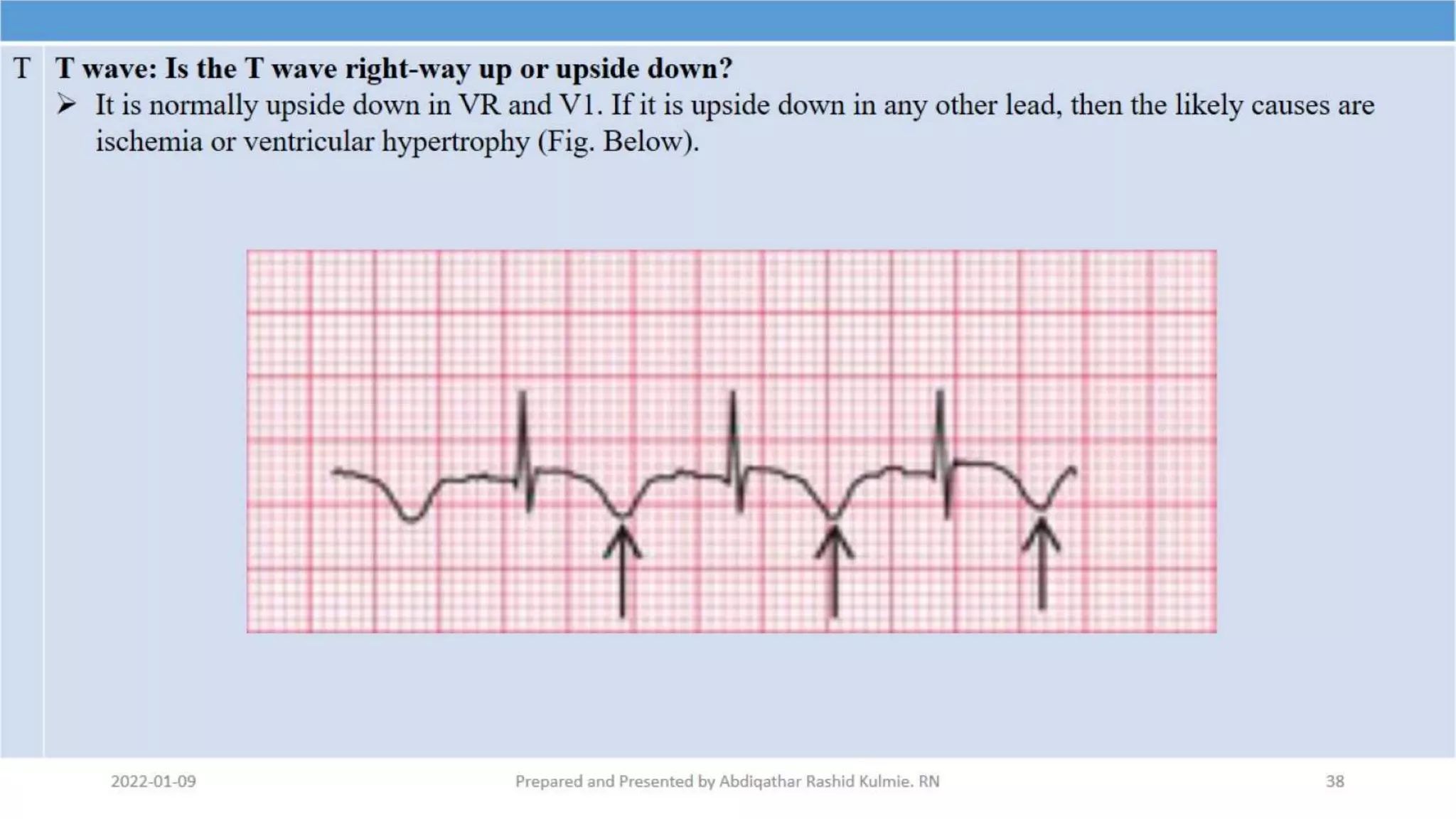 Basic electrophysiology, interpretation, cardiac monitoring and ...