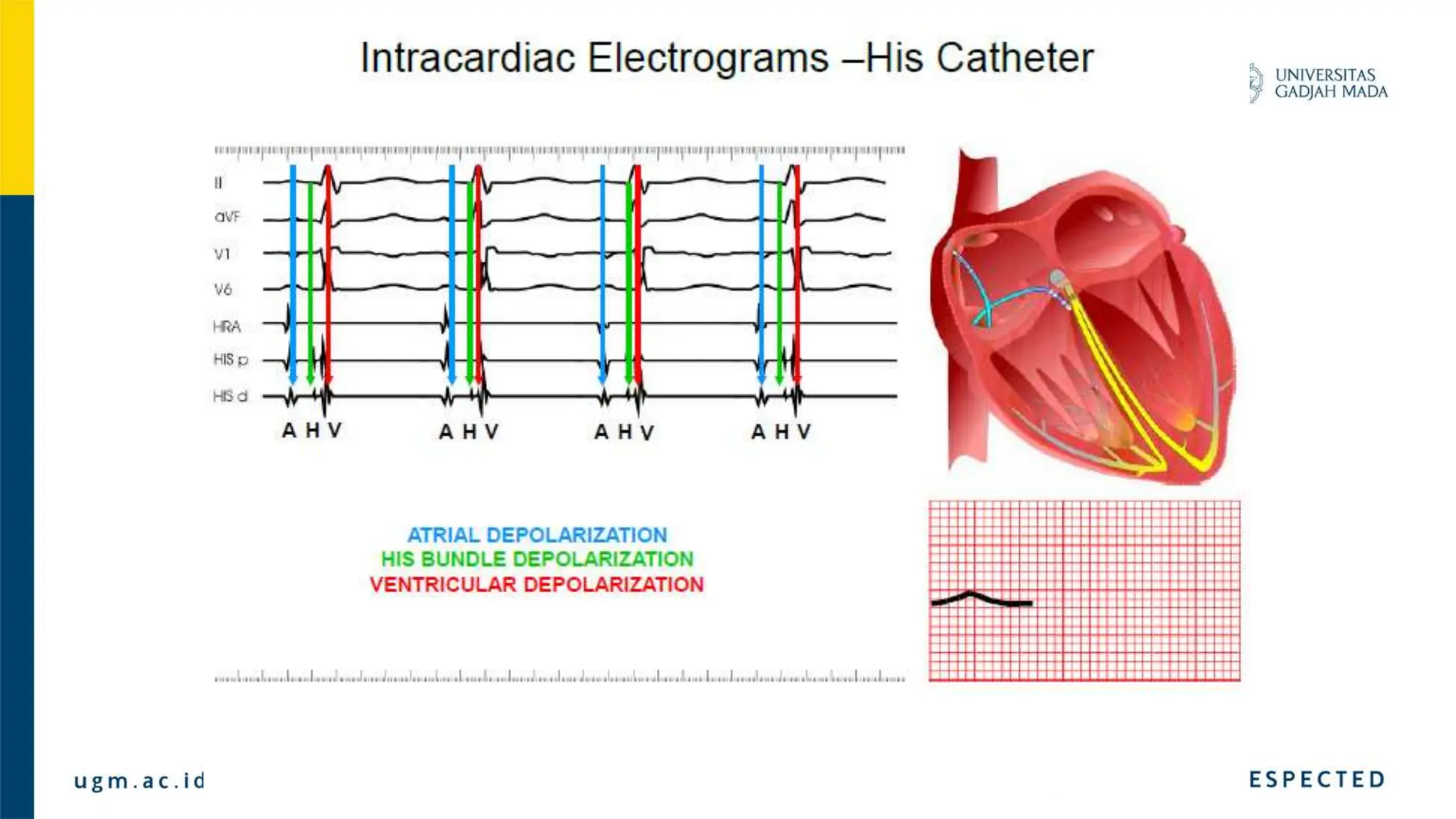 Basic Electrophysiology study and EGM material.pptx