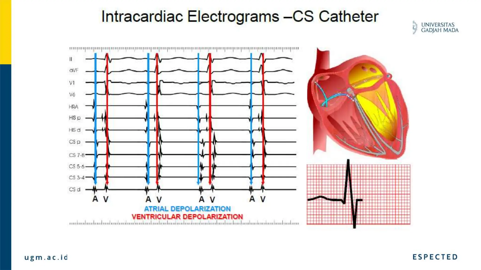 Basic Electrophysiology study and EGM material.pptx