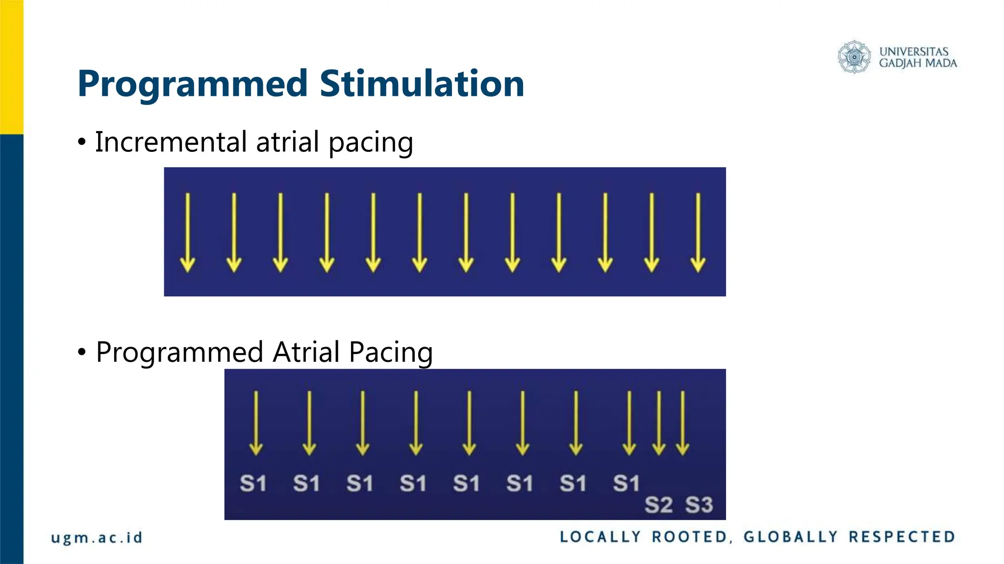 Basic Electrophysiology study and EGM material.pptx