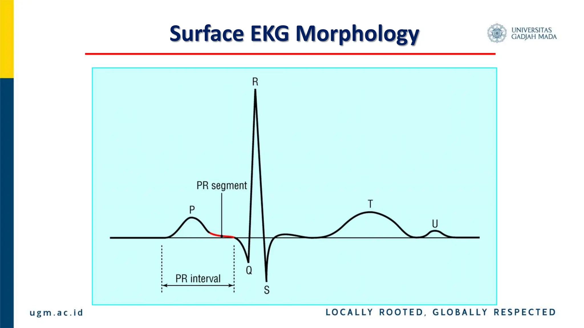 Basic Electrophysiology study and EGM material.pptx