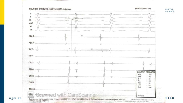 Basic Electrophysiology study and EGM material.pptx | Heart and ...