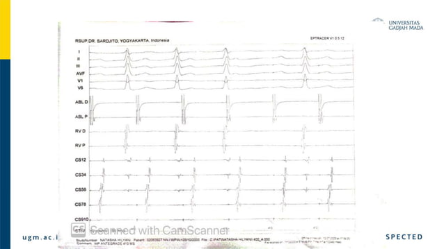 Basic Electrophysiology study and EGM material.pptx | Heart and ...