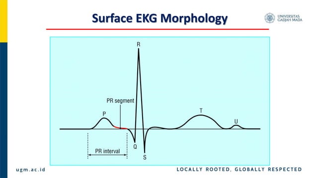 Basic Electrophysiology study and EGM material.pptx | Heart and ...