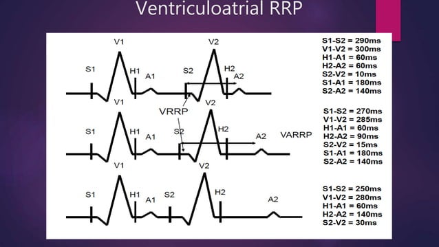 Basic EP study (part1) | PPTX