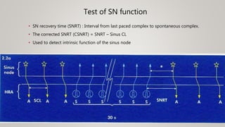 Basic EP study part 2 | PPTX