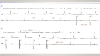 Basic EP study part 2 | PPTX