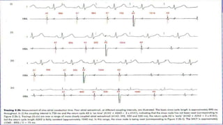 Basic EP study part 2 | PPTX