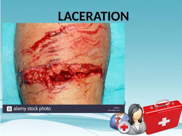 Introduction to First AID and Basic FA and BLS.pptx