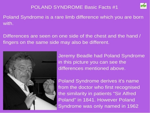 Poland Syndrome 10 Basic Facts