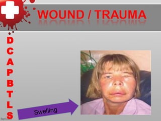 Basic first aid | PPT