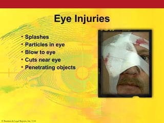 Basic first aid | PPT