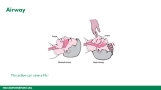 Basic First Aid - Cardiopulmonary Resuscitation (CPR) | PPTX