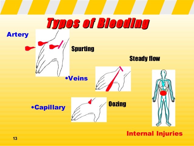 Types Of Bleeding