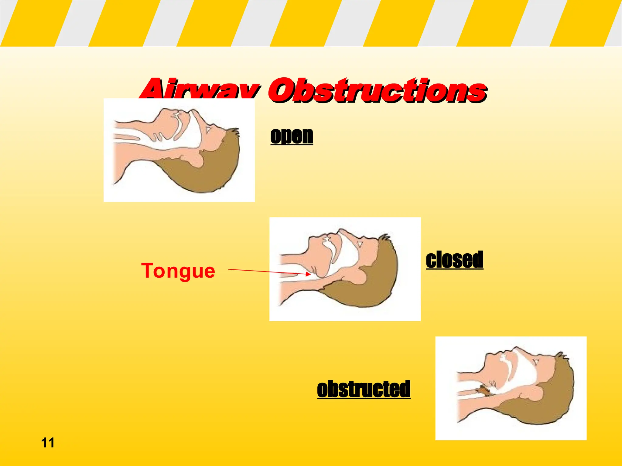 Basic FIRST AID PRINCIPLES AND APPROPRIATE MEASURES | PPT