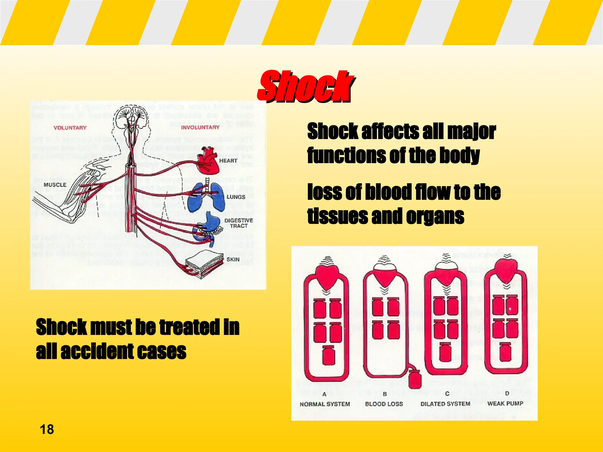 Basic FIRST AID PRINCIPLES AND APPROPRIATE MEASURES | PPT