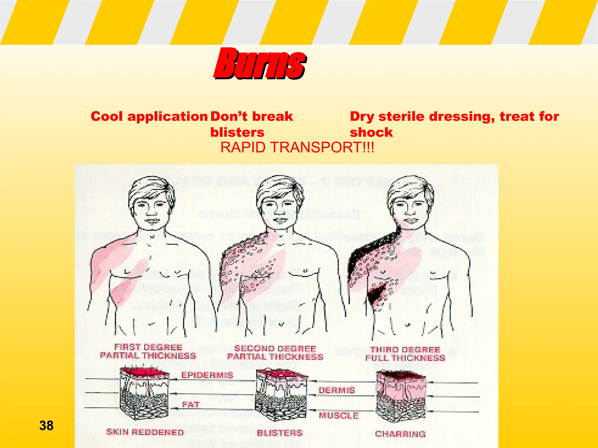 Basic FIRST AID PRINCIPLES AND APPROPRIATE MEASURES | PPT