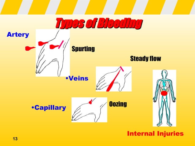 Basic FIRST AID PRINCIPLES AND APPROPRIATE MEASURES | PPT