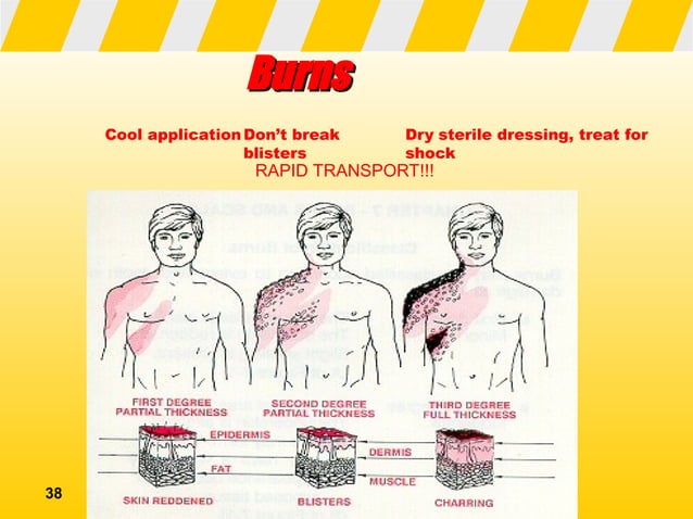 Basic FIRST AID PRINCIPLES AND APPROPRIATE MEASURES | PPT