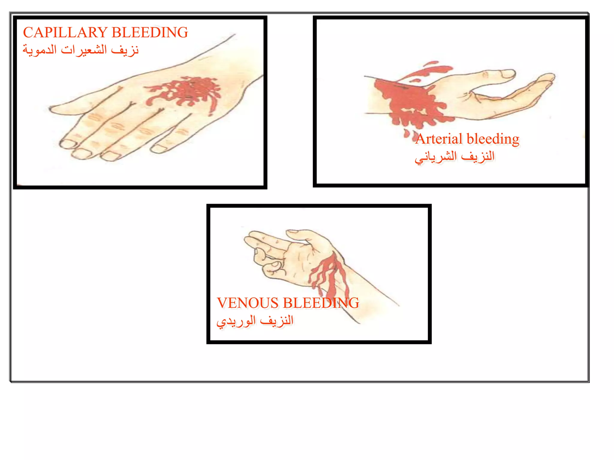 Basic First Aid.pptx