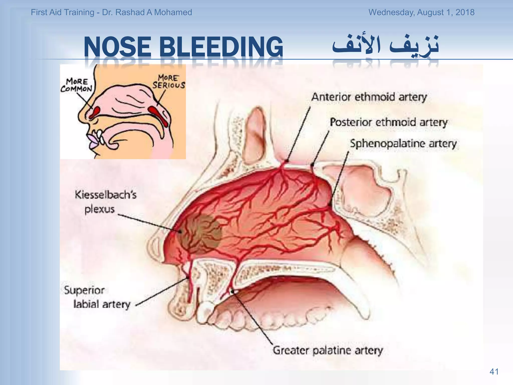 Basic first aid english version | PPTX