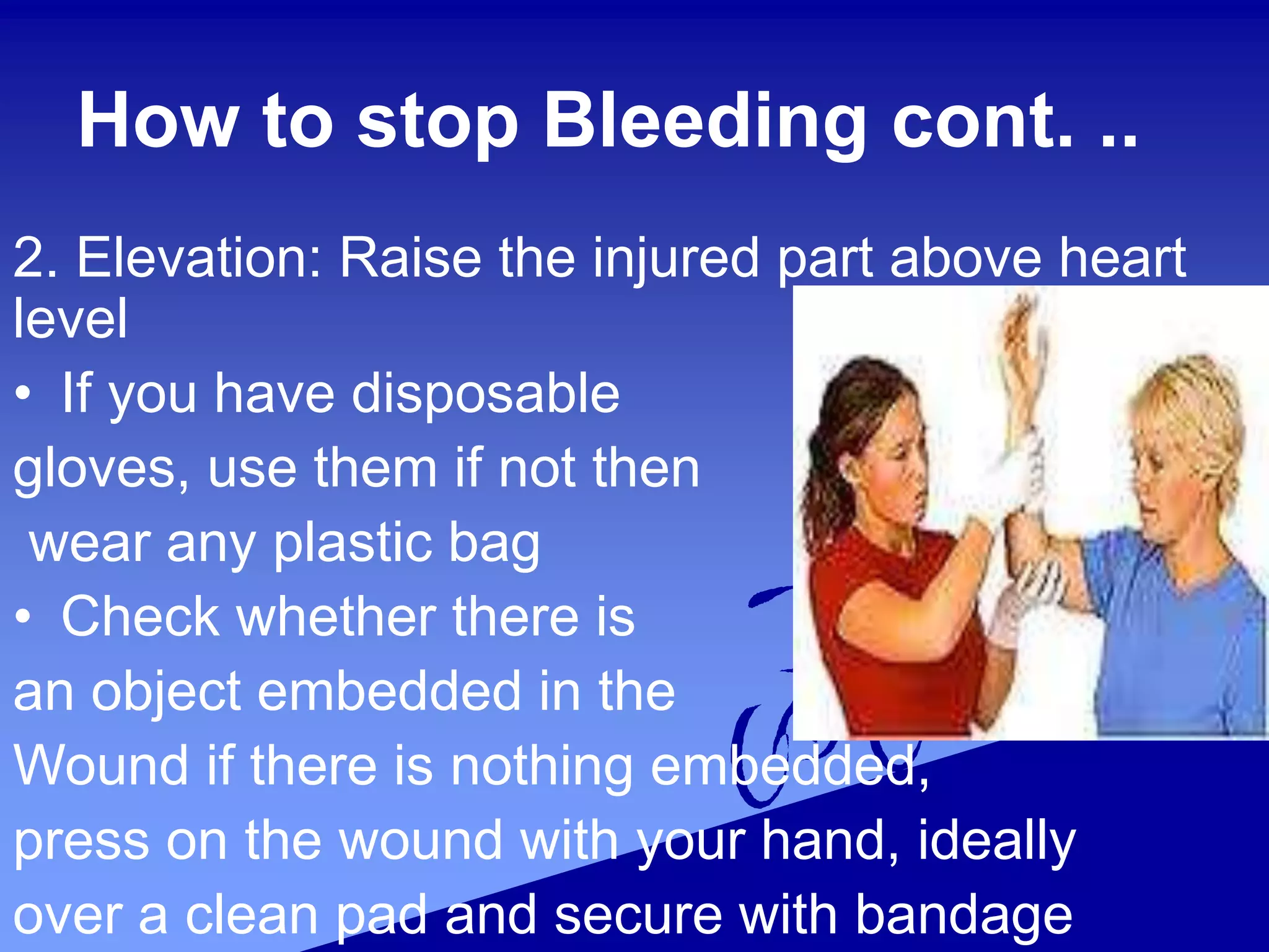 Basic first aid for beginners | PPTX