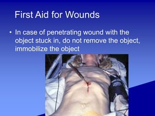 Basic first aid for beginners | PPTX