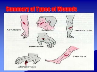 Basic first aid for beginners | PPTX