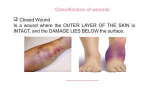 BASICS FIRST AID PART DISCUSSIONS 2.pptx