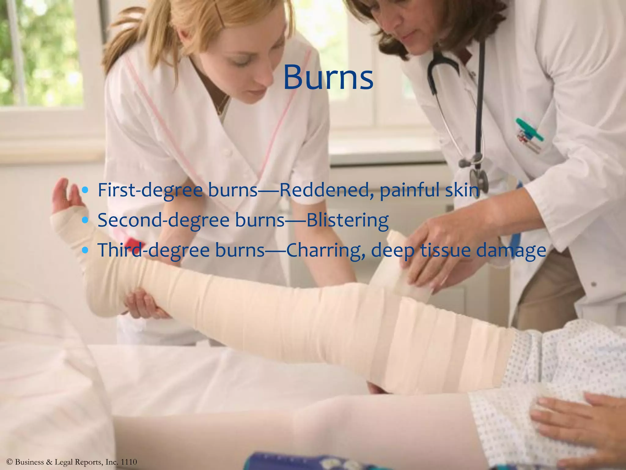 Basic First Aid Training By ISTI | PDF | First Aid | Injuries