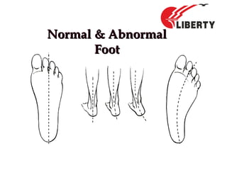 Basic Foot Anatomy and Foot Mechanics | PPT