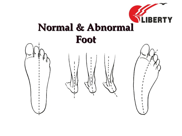 Basic Foot Anatomy and Foot Mechanics | PPT