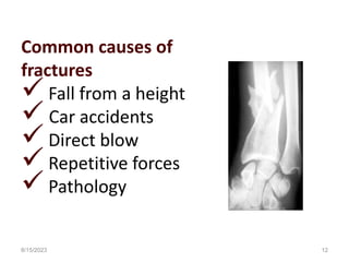 Basic Fracture Management.ppt