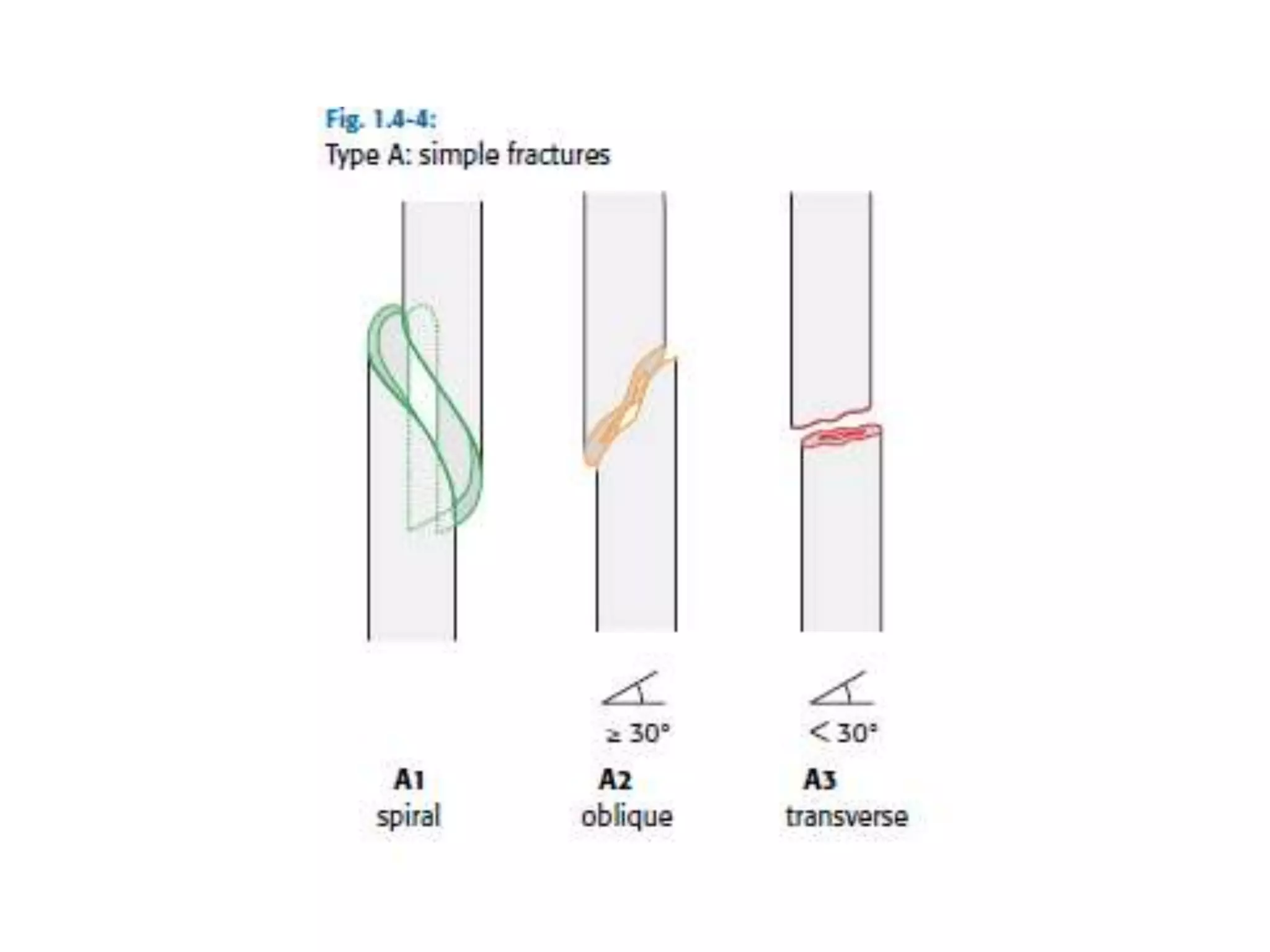 basic fracture management JUNE.pptx