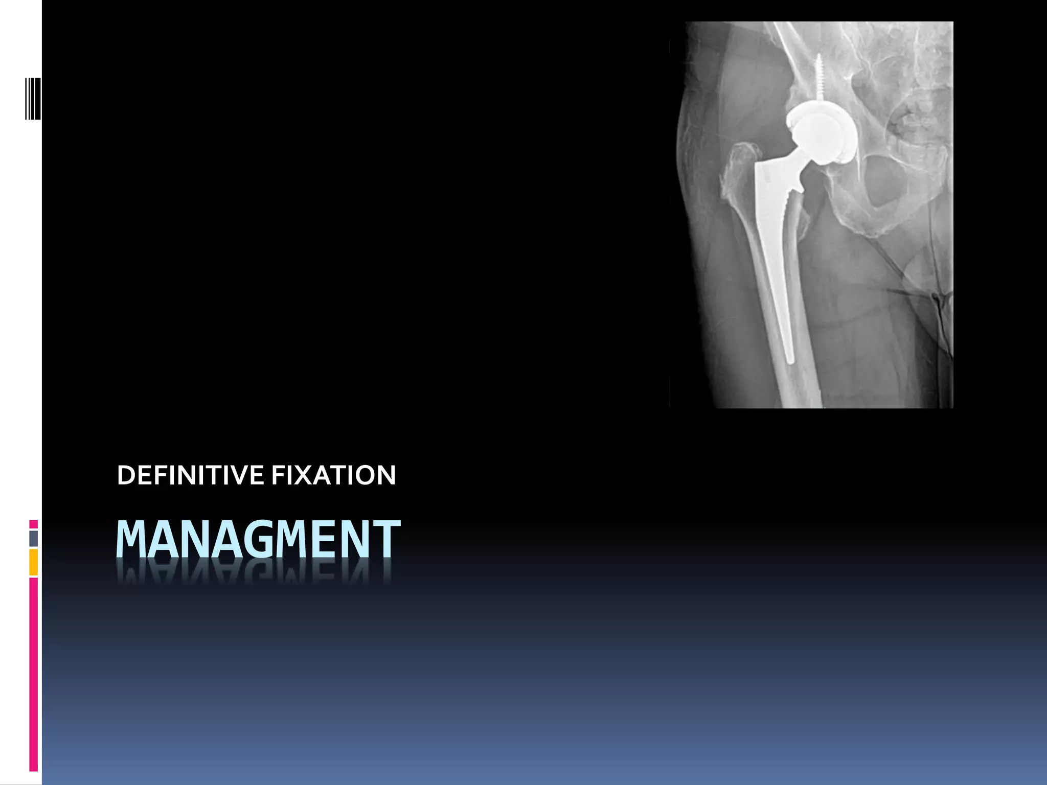 Basic fracture management | PPTX