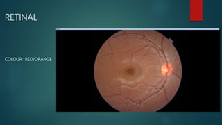 Basic fundoscopy | PPTX
