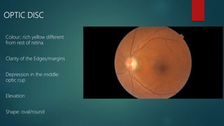 Basic fundoscopy | PPTX