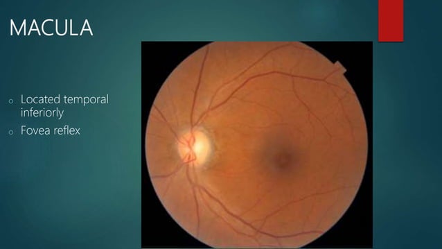 Basic fundoscopy | PPTX | Eye and Vision Conditions | Diseases and ...