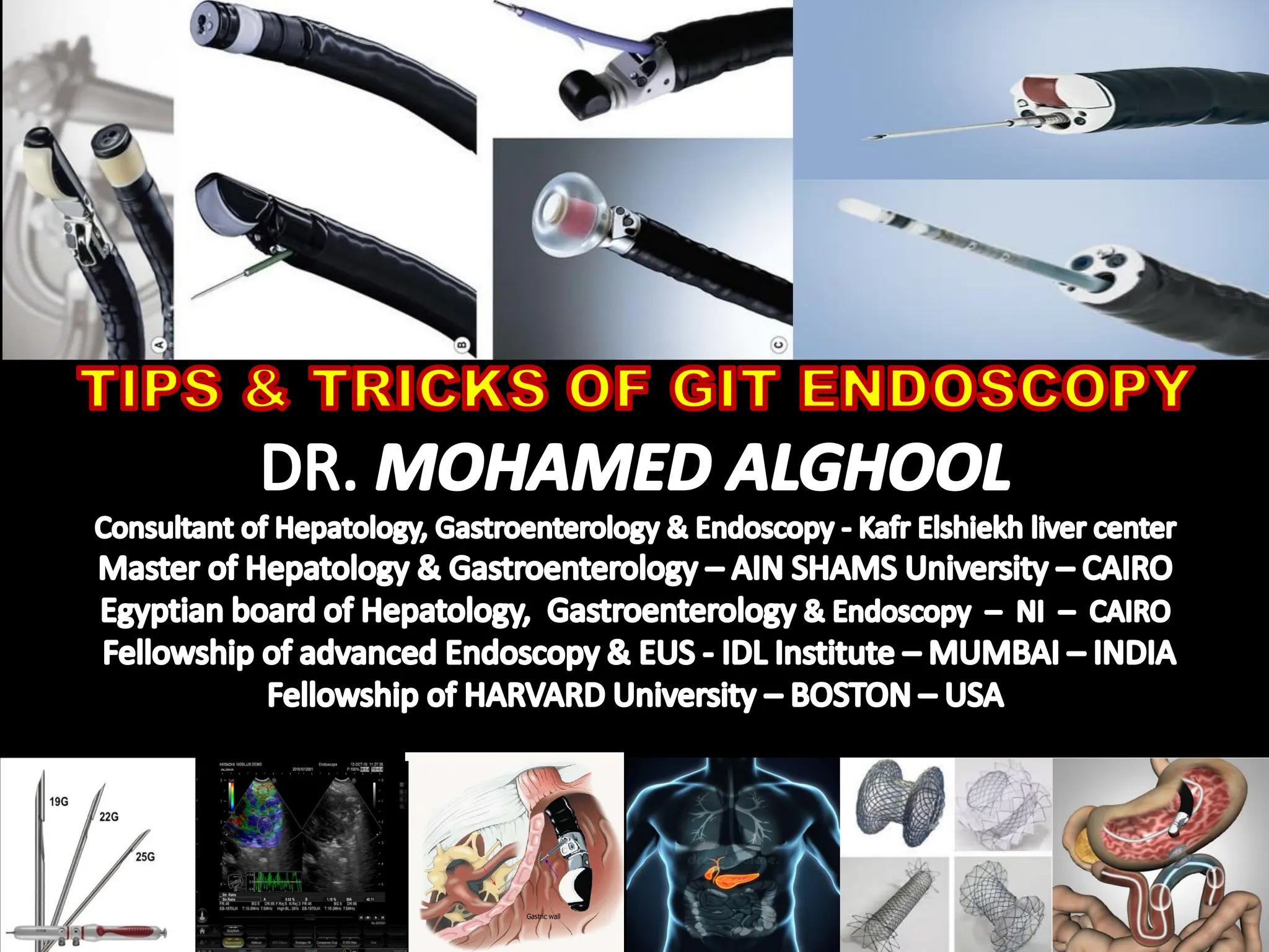 Tips & tricks of Gastro intestinal Endoscopy.pdf