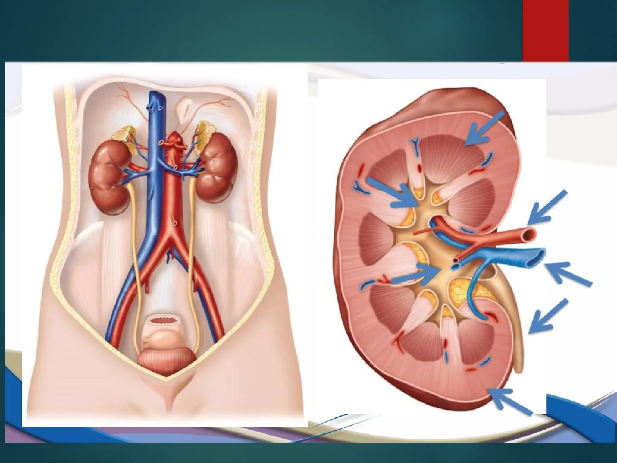 basic Genitourinaria Imaging in basic .ppt