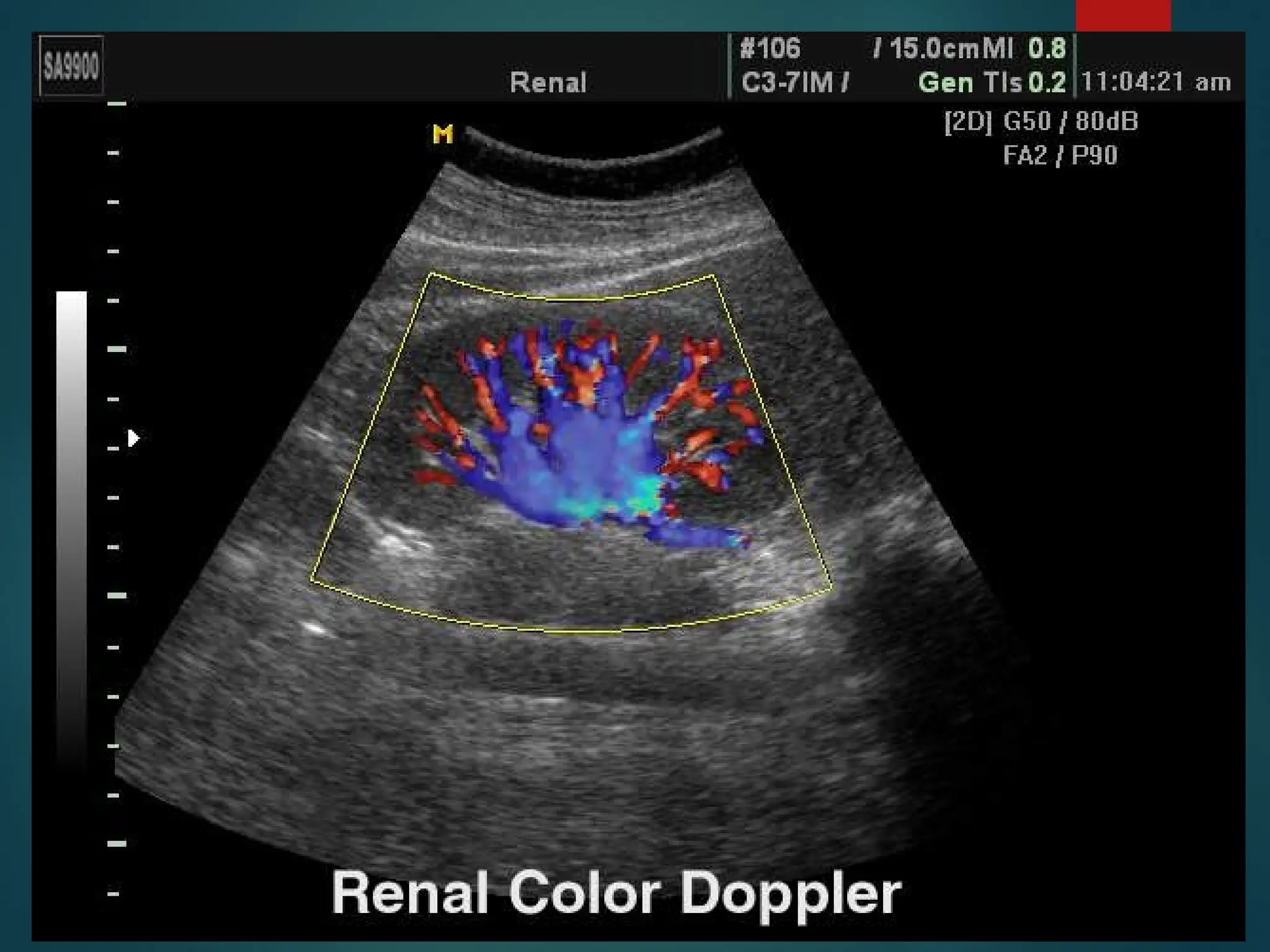 basic Genitourinaria Imaging in basic .ppt