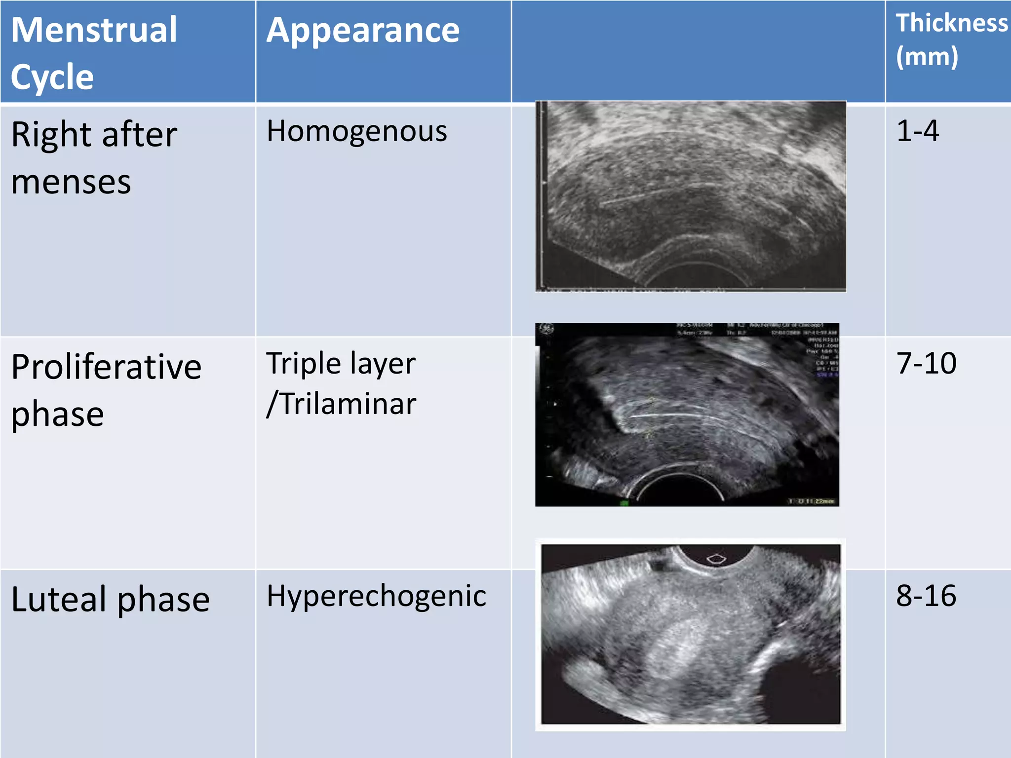 Basic gynae ultrasound | PPTX