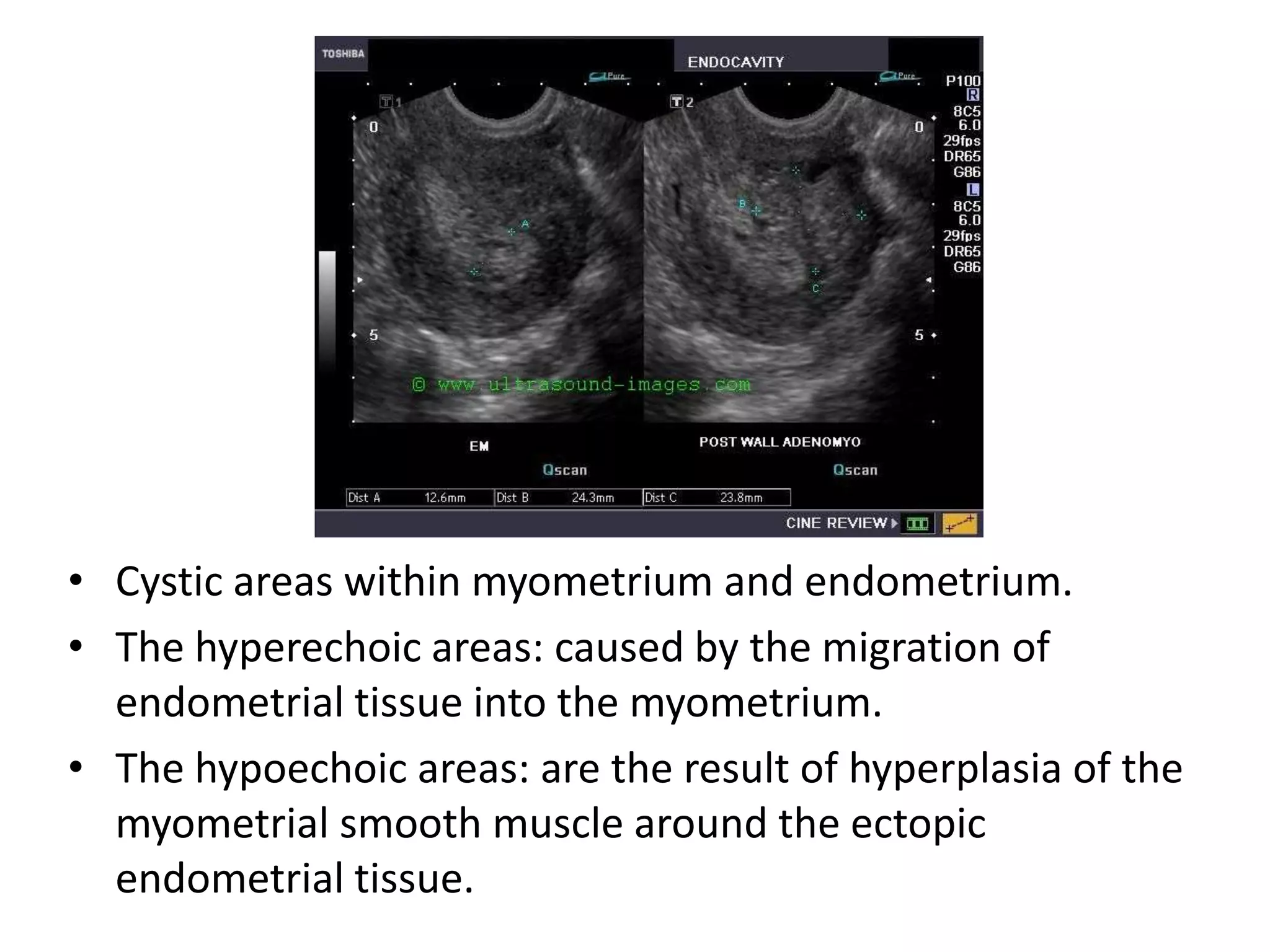 Basic gynae ultrasound | PPTX